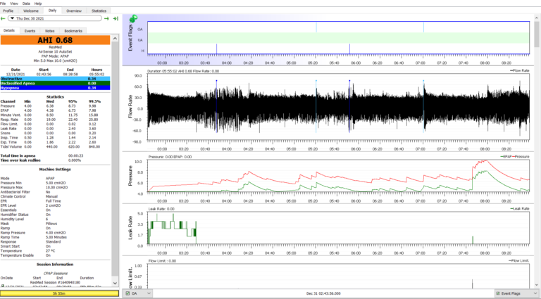 CPAP - Data & Settings Review - Sentient Foundry
